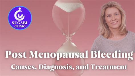 Postmenopausal Bleeding Guidelines Cks At Ruby Vannatter Blog