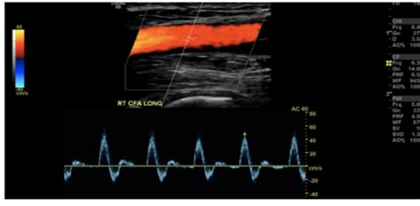 Clinical Final Waveforms Flashcards Quizlet