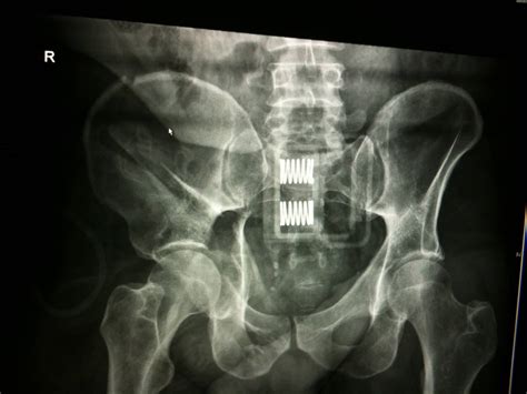 Radiology Case 20 Intensive Care Network