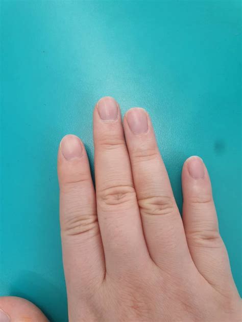 대박 새끼 손가락 휘어짐ㅋㅋㅋㅋㅋㅋ 인스티즈 Instiz 익명잡담 카테고리