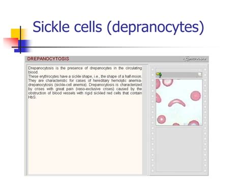 Classifications Of Anemias 5830599 Ppt