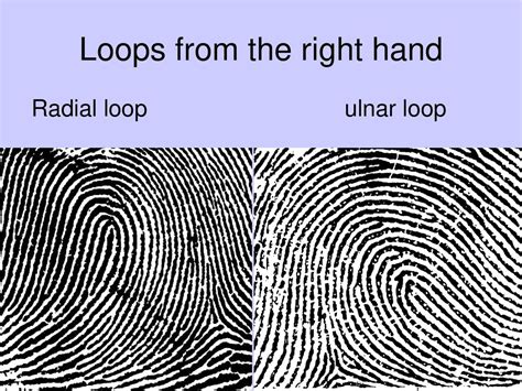 Ulnar Loop Vs Radial Loop Fingerprint