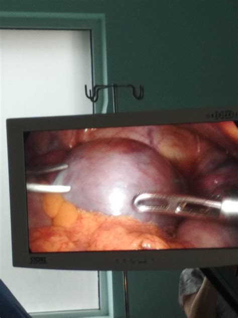 ელენე ასანიძე მეან გინეკოლოგი ბავშვთა გინეკოლოგი პროფესორი