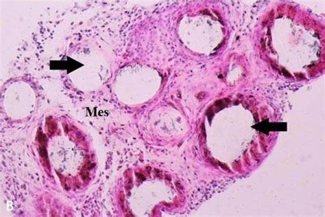 A Morphology Of A Normal Omentum Densely Arranged Mesothelial Cells