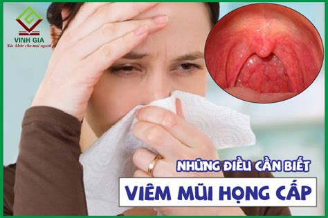 Viêm mũi họng cấp Điều trị và phòng ngừa như thế nào