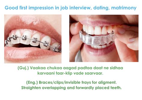 Orthodontics Tooth Alignment In Ahmedabad Best Dental Clinic In Gota Dr Maulik Dental Care