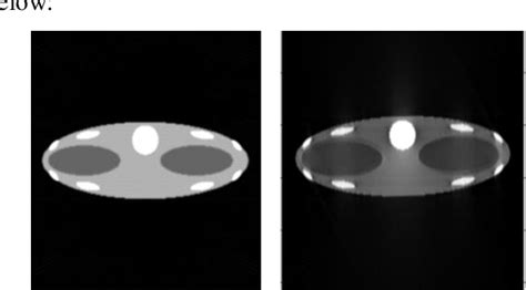 Figure 3 From Reconstruction Of Parallel And Fan Beam Projections For Biomedical Diagnosis