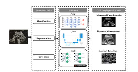 Prediction Of Fetal Brain And Heart Abnormalities Using Artificial Intelligence Algorithms A Review