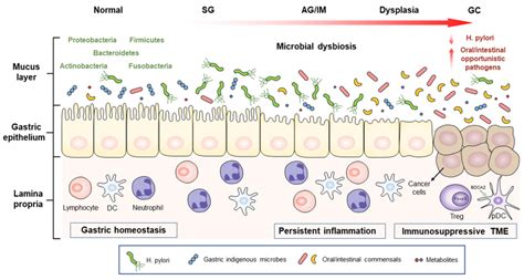 Schematic Representation Of The Gastric Microbial Alteration Across Download Scientific Diagram