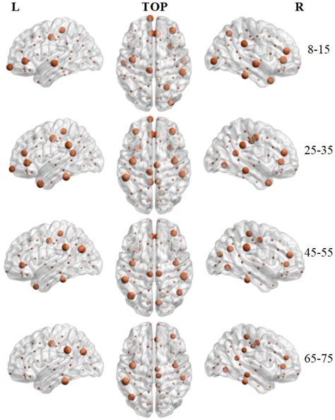 Frontiers Development Of Brain Structural Networks Over Age 8 A