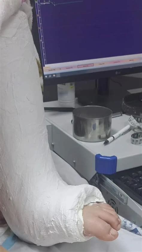 دختر 18 ساله برای حفظ آبرو از پل عابرپیاده به پایین پرید دو زورگیر به