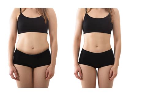 Ultrasonic Cavitation Before And After Konmison