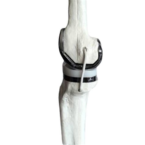 Knee Joint Model Simulation Replacement Surgery Meniscus Ligament