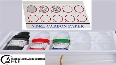 Vdrl Venereal Disease Research Laboratory Principle Procedure