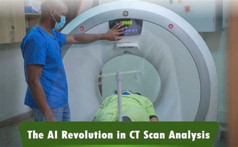 The Ai Revolution In Ct Scan Analysis The Ai Revolution In Ct Scan Analysis