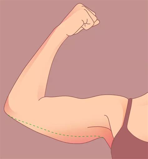 Brachioplasty In Mexico Dr Manuel Sevillano Plastic Surgeon