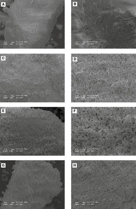 Scanning Electron Microscopy Sem Image Of In Natura Eggshell Expanded Download Scientific