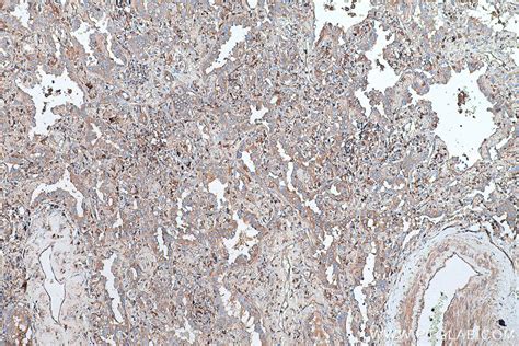 Ihceasy Msn Ready To Use Ihc Kit Khc0664 Proteintech 武汉三鹰生物技术有限公司