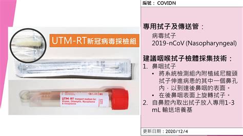 通告新冠病毒核酸檢驗、抗原檢查檢體類型要求