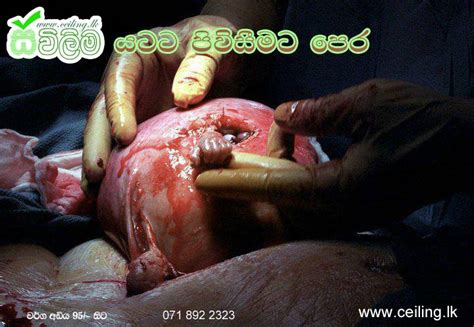 සිවිලිම අඩු වියදම් සිවිලිම අනර්ඝම ඇලුමිනියම් රාමු මැලේෂියන් ෂීට් තීන්ත ආලේපය ප්‍රවාහනය හා