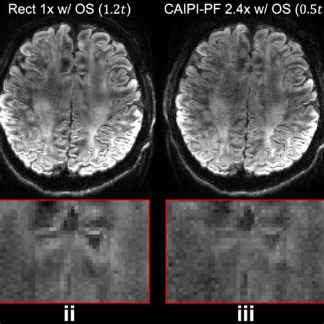 Boundary Slice Aliasing Correction The Boundary Slices A And Download Scientific Diagram
