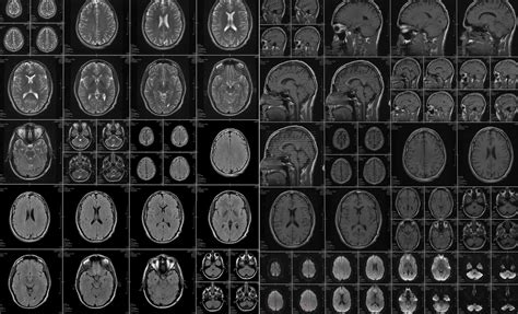 Memory Bank Phmuseum