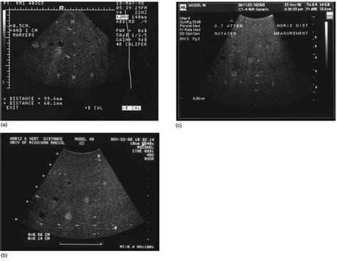A Image Demonstrating Correct Positioning Of Cursors For Horizontal And Download Scientific