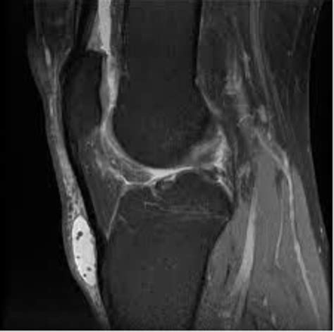 Protocols Week 9 Flashcards Quizlet