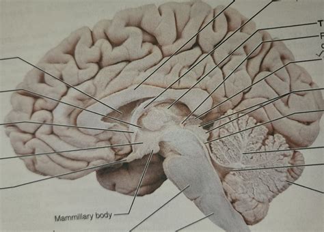 Diencephalon And Brain Stem Diagram Quizlet