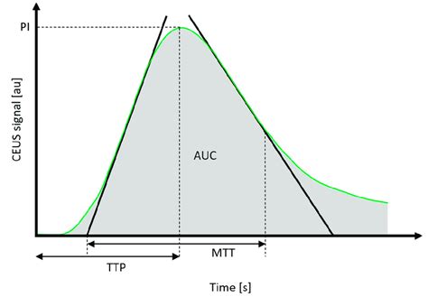Quantitative Time To Intensity Ceus Curve Parameters Ceus
