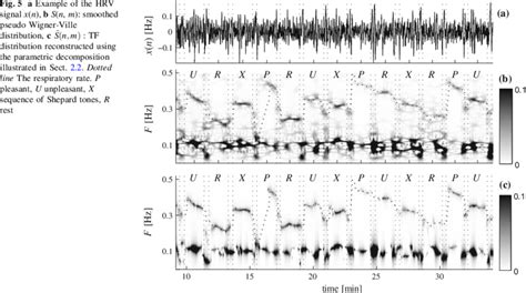 A Example Of The Hrv Signal X N B S N M Smoothed Pseudo
