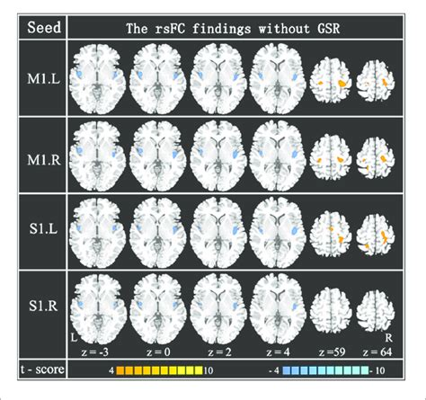 Resting State Functional Connection Findings Without Gsr Patterns Of