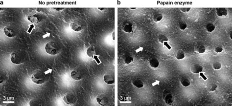 Deproteinization With Papain Enzyme Improves The Bonding Performance Of