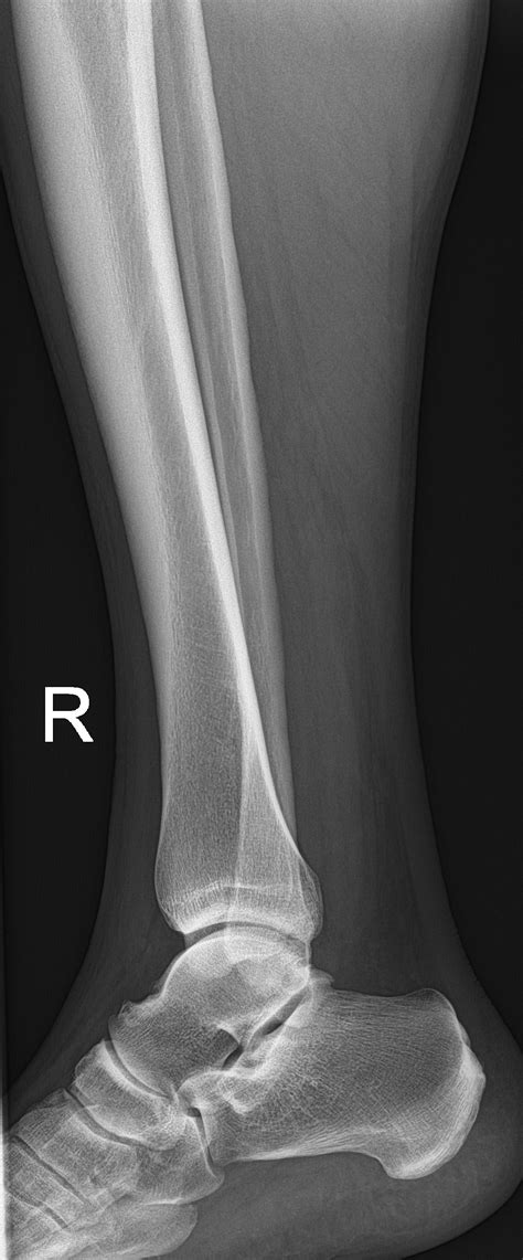 Image Radiopaedia Org