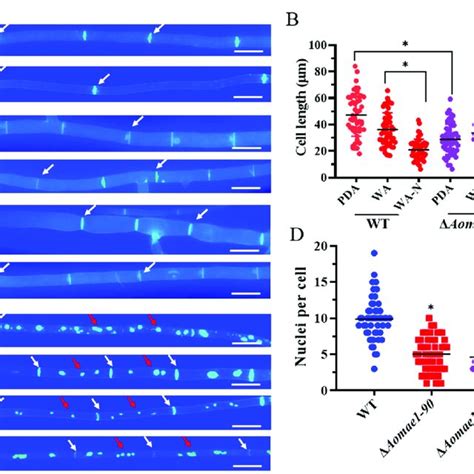 Comparison Of The Cell Length And Nuclei Between Wt And Mutant Strains