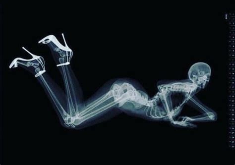 Sexy Skeleton Tuesday Is Back R Neverbrokeabone