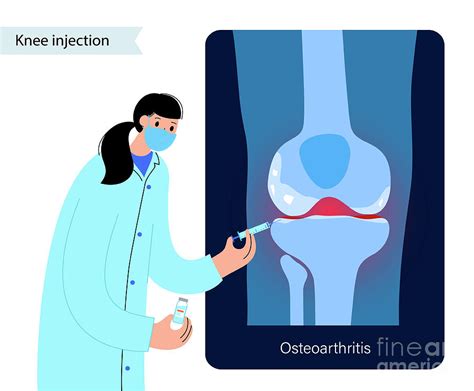 Knee Injection Photograph By Pikovit Science Photo Library Fine Art
