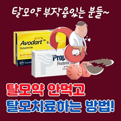 탈모약 복용 안하고 탈모치료 하는 방법 Ft 부작용 있는 경우 탈모의학 그누보드5