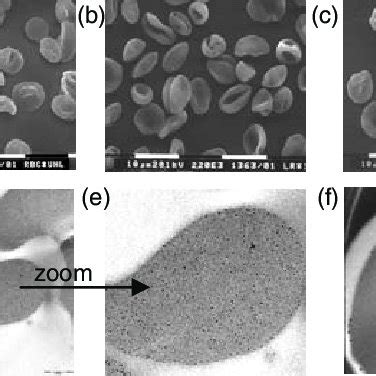 Electron Microscopy Images Of Human Erythrocytes A C SEM Analyses Download Scientific Diagram