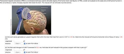 Solved Transcranial Magnetic Stimulation Tms Is A