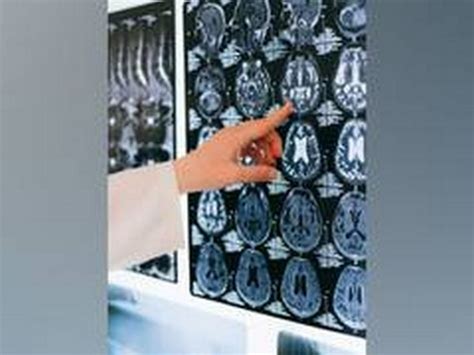 Brain Region Is Key Locus Of Learning Neuroscientists