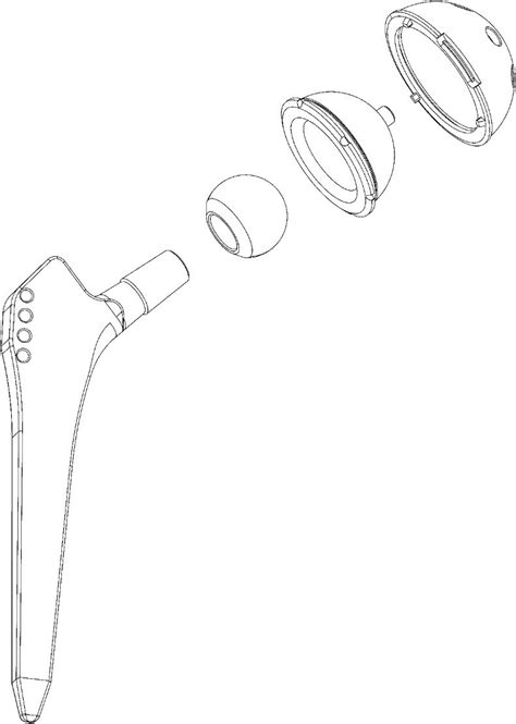 Эндопротез тазобедренного сустава тотальный с парой трения металл полиэтилен бесцементной