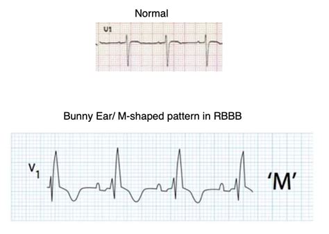 ECG S Lunchtimes With Bella