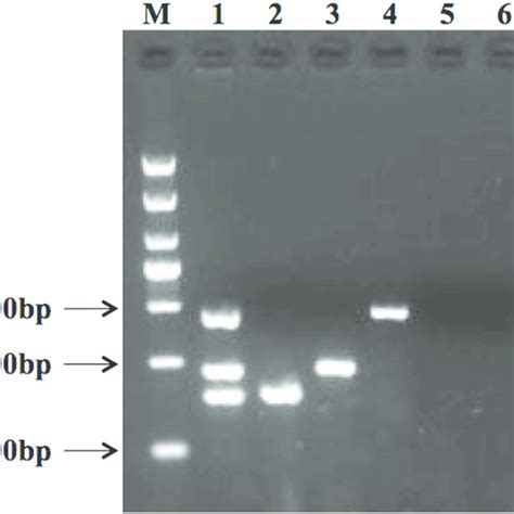 Multiplex Pcr Result Of L Monocytogenes E Coli O157 H7 And S Download Scientific Diagram