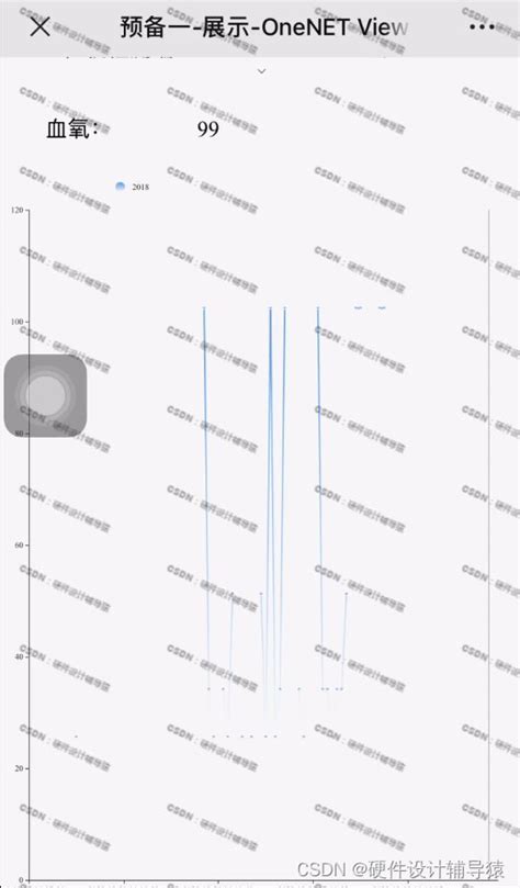 【毕业设计】stm32心电图系统 Csdn博客