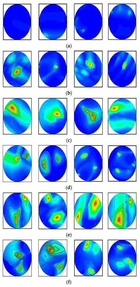 A Lightweight Deep Learning Based Microwave Brain Image Network Model For Brain Tumor