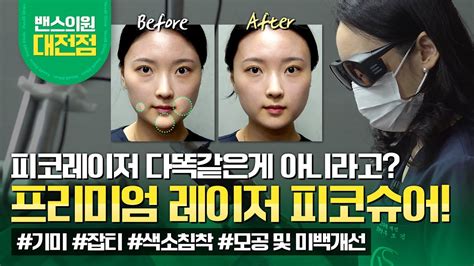 다 똑같은 피코가 아니라고 프리미엄 피코슈어레이저 Youtube