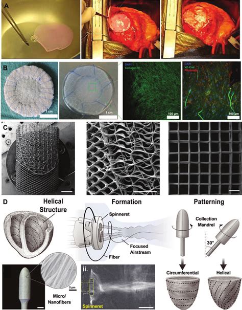 Examples Of The Most Recent Tissue Engineering Technologies A
