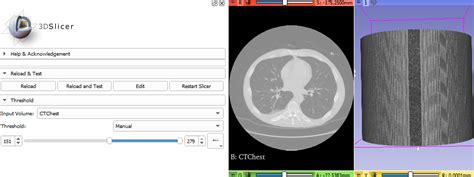 how to use python to achieve the thresholding effect of the ‘volumes module synchronized with