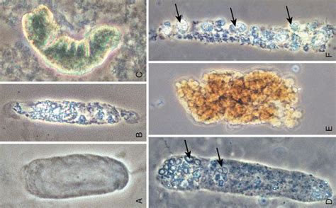 Medical Laboratory And Biomedical Science Urinary Casts